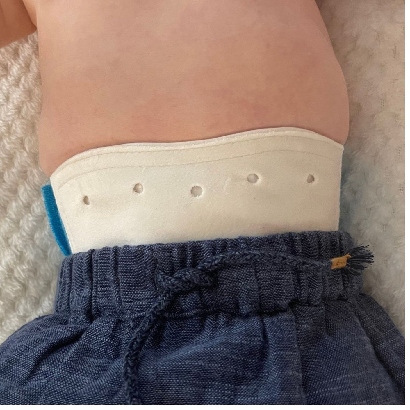 Baby Hernia Belt – Belly Bands